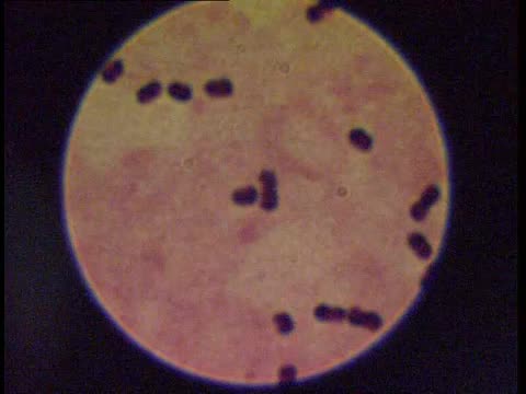Streptococcus pneumoniae viewed through microscope - Wazee Digital